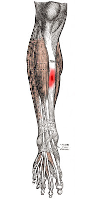 Injury Series: Tibial stress fractures and stress reactions: The role ...