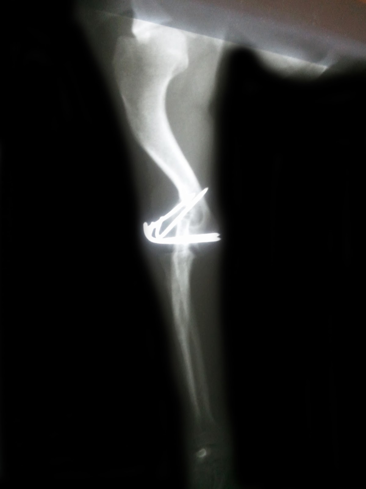 ARTROVET: Fractura y luxación de codo