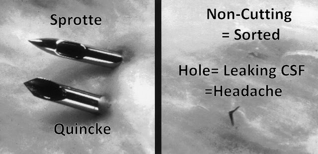 Multiple Sclerosis Research: Give me a Sprotte Not a Headache!