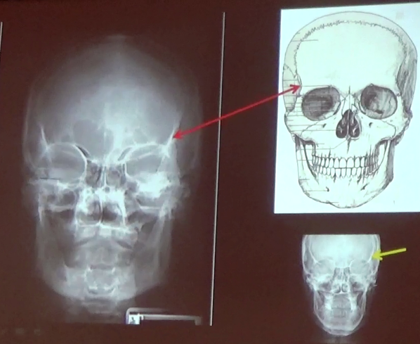 RADIOANATOMIA: CLASE 11