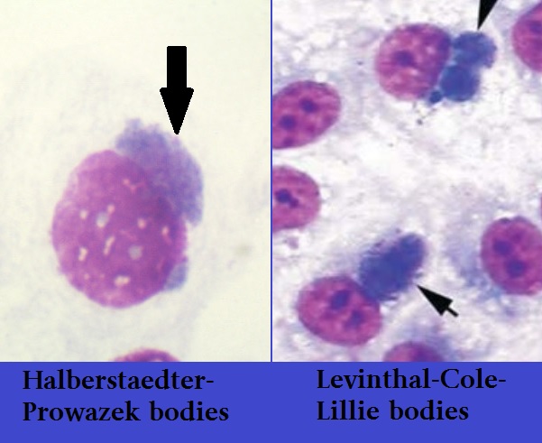 Lecture Notes in Medical Technology: Lecture #15: RICKETTSIA, CHLAMYDIA ...