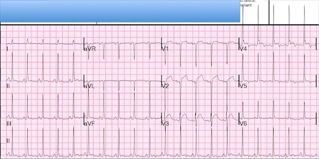 Dr. Smith's ECG Blog