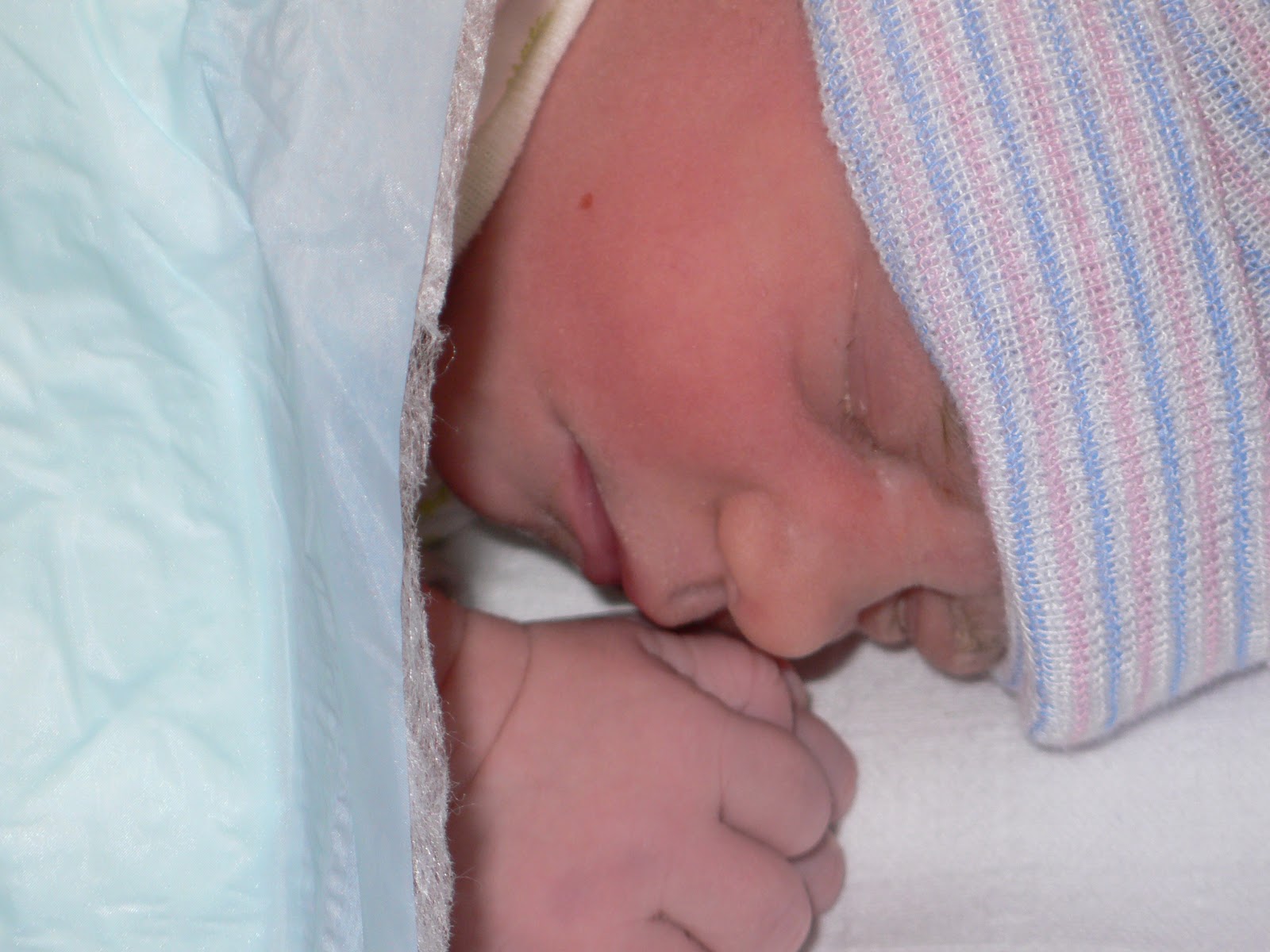 Leafde hat wun!: Choane Atresie