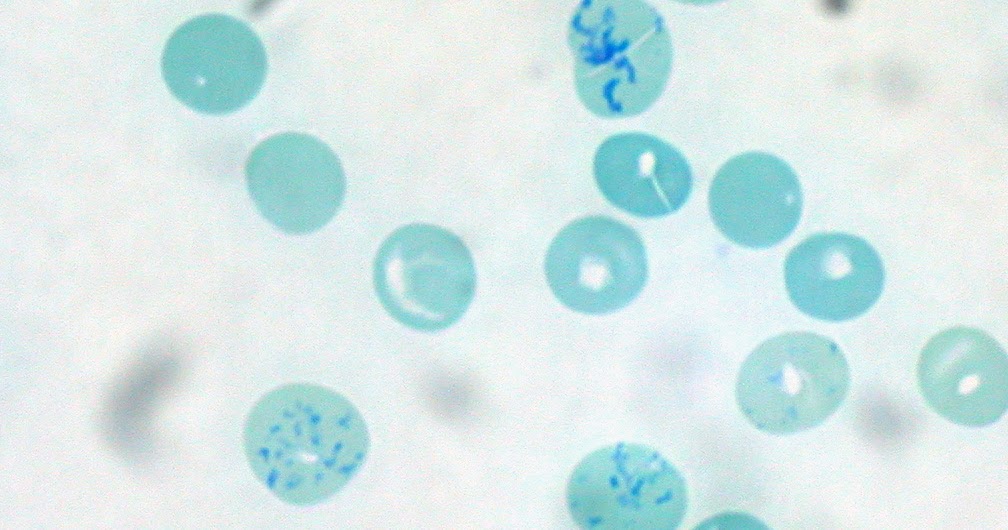 活體染色法(Vital stain)