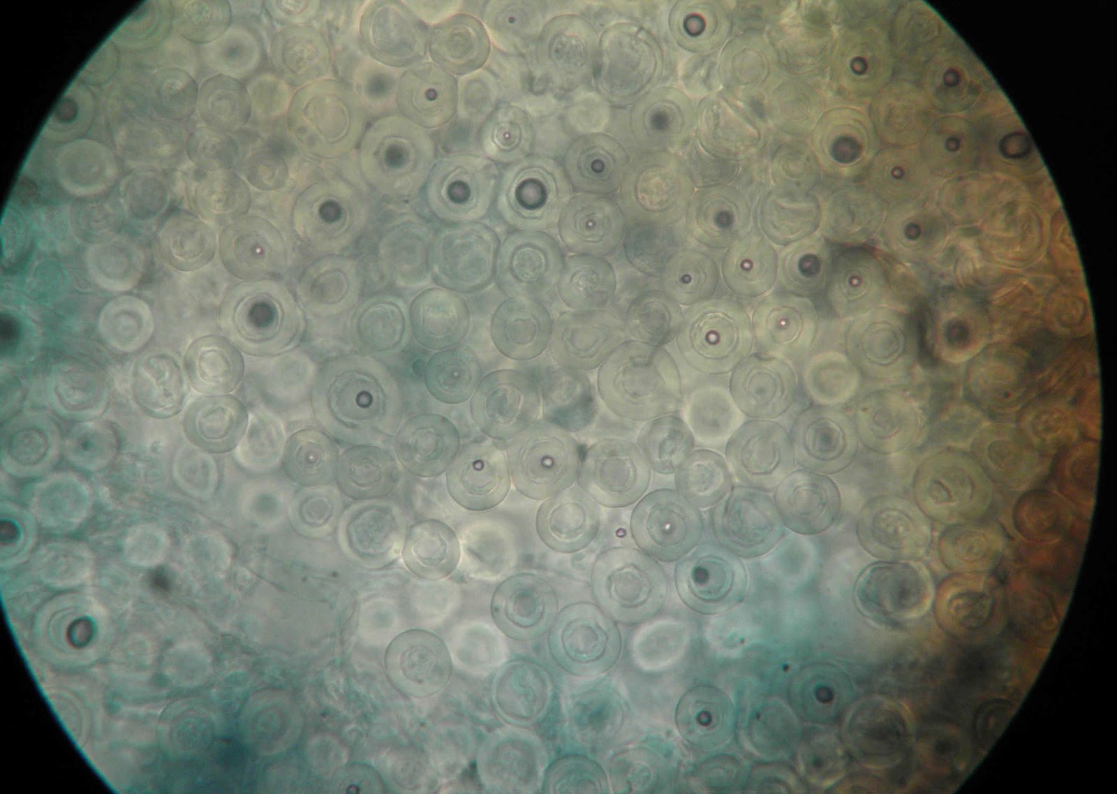ATLAS MICOLOGIA: ASPERGILLUS NIDULANS