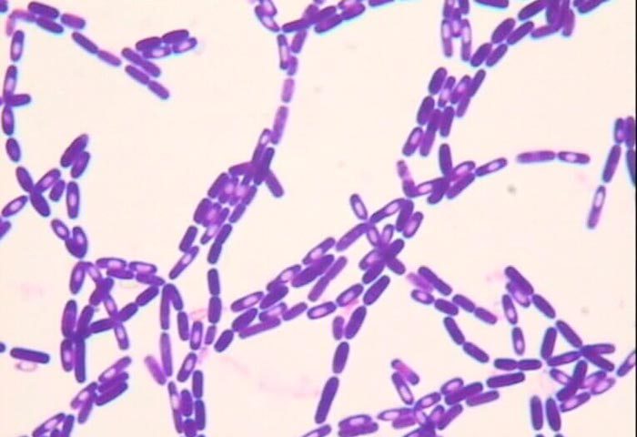 Bacillus cereus