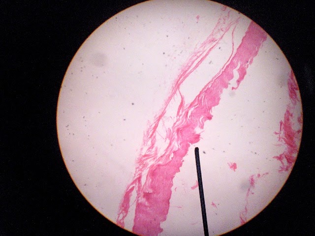 HISTOLOGIA MEDICINA UCC PASTO: NERVIOSO