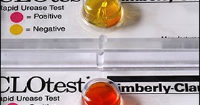 Ayurvedic Treatment for RUT (Rapid Urease Test) Positive - Helicobacter ...