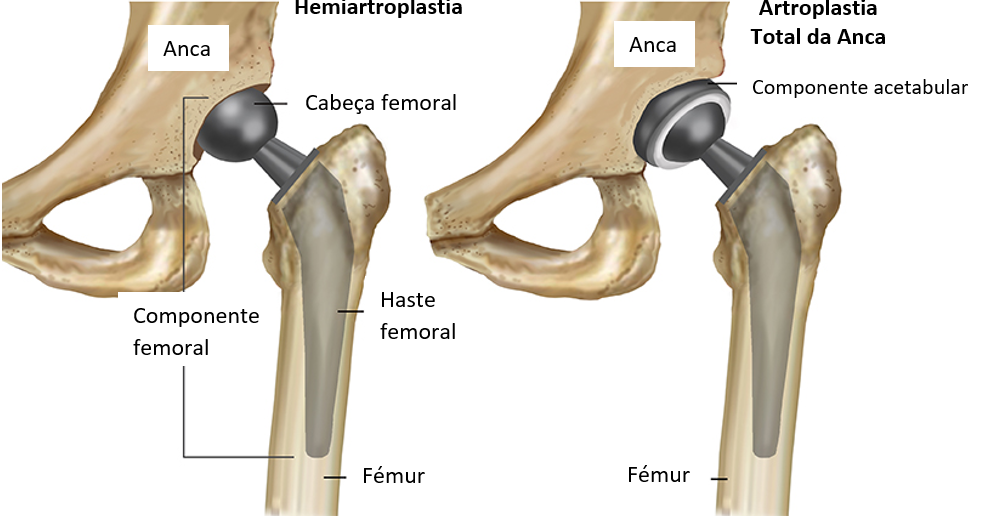 Bem - estar e Movimento