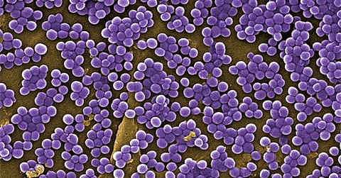 Sfaturi Utile: Despre stafilococul auriu