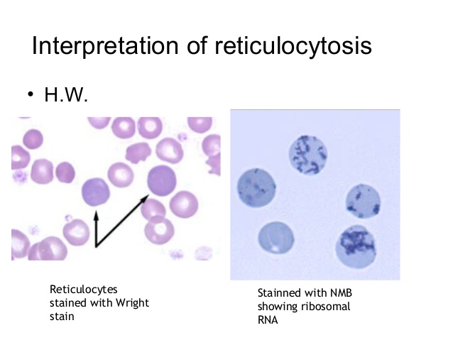 Blog Juruteknologi Makmal Perubatan @ MAD LAB BLOG: KITARAN SEL DARAH ...
