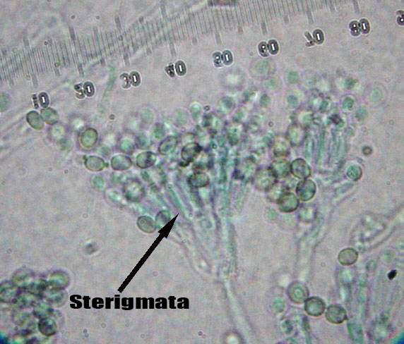 Fungal Structures and Mycology Terminologies Essential for ...
