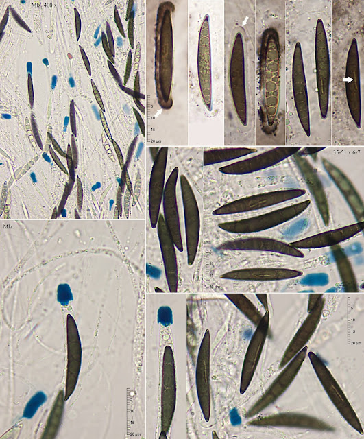 Rosellinia necatrix Prill. • CEMAS Orden Xylariales, Hongos patógenos