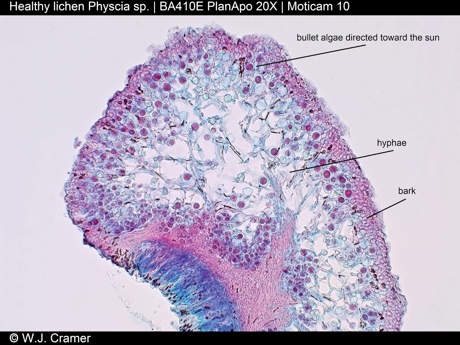 Physcia Under Microscope