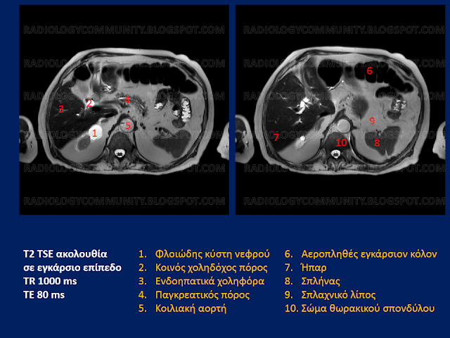 Radiology Community: Ιανουαρίου 2018