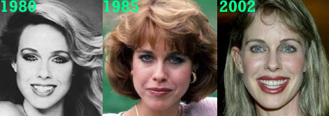 Jenilee Harrison Plastic Surgery Before and After | Plastic Surgery