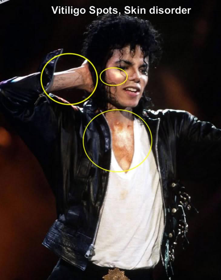 Michael Jackson Últimas Noticias: MICHAEL JACKSON Y SU COLOR DE PIEL