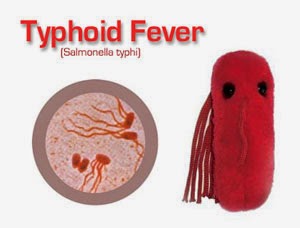 AKU HIV POSITIF: HIV & SUNTIKAN TYPHOID