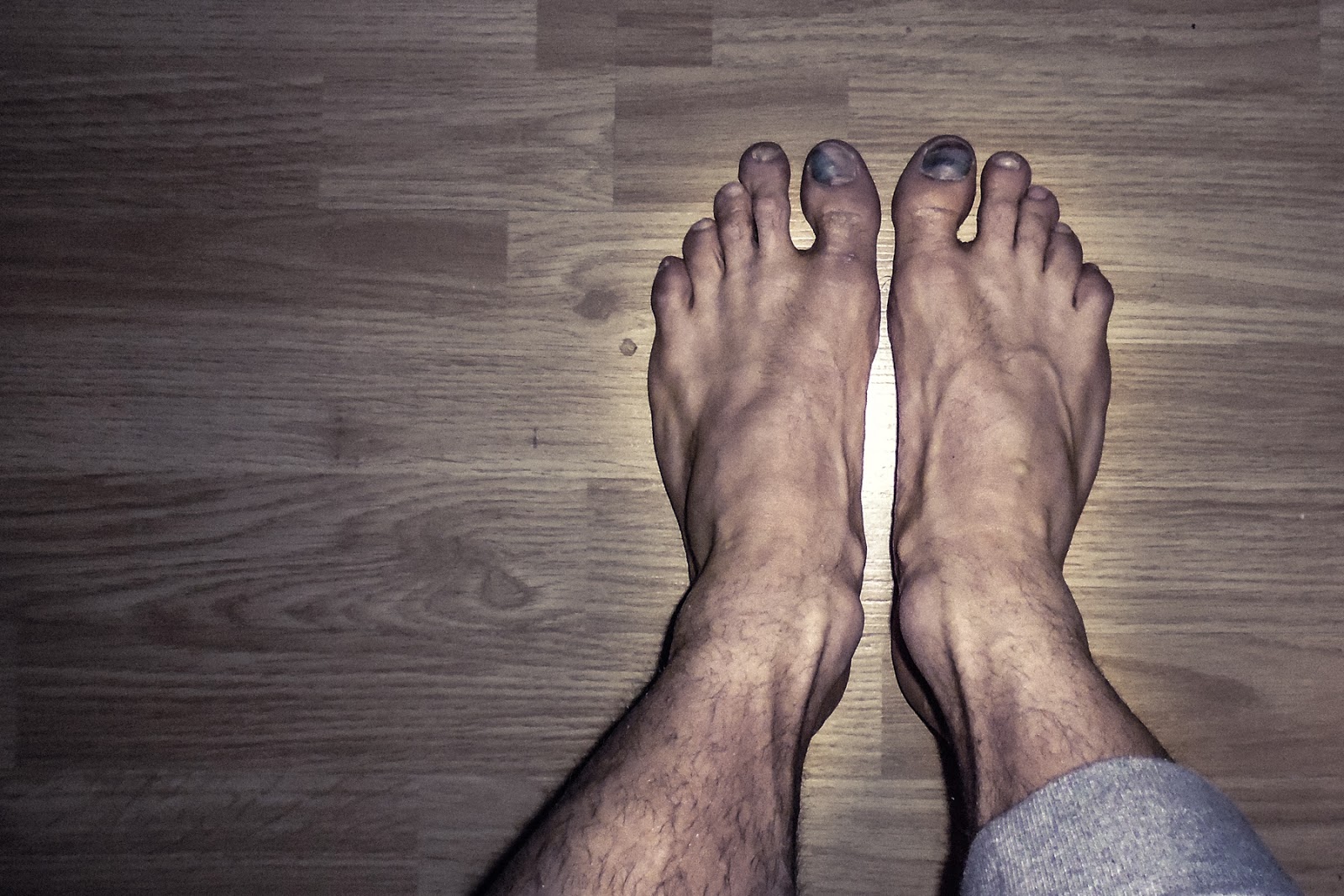 The ugliest feet - Running to Think