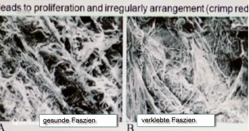 MUNICH GETS STRONG: Faszien Workshop am vergangenen Wochenende