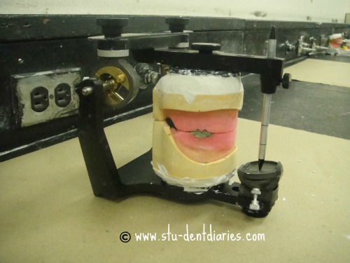 Stu-DENT Diaries: Removable Prosthodontics: Mounting Casts