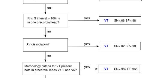 Brugada Criteria Untuk Membedakan VT dan SVT dengan Aberansi | INA - ECG