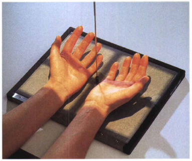 HAND X - RAY | AP OBLIQUE BILATERAL | BALL CATCHERS / NORGAARD METHOD ...