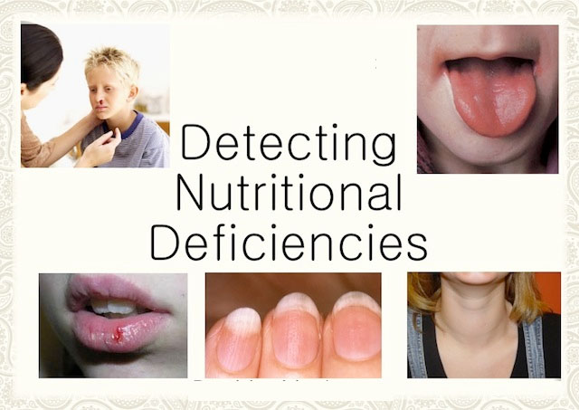 Free Health Tips | Good Nutrition | Healthy Diet Child: Detecting ...