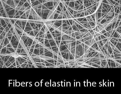Understanding Williams Syndrome: Cardiovascular
