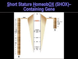 DEFICIÊNCIA COM BAIXA ESTATURA CONTENDO HOMEOBOX GENE (SHOX) EM CRIANÇA ...