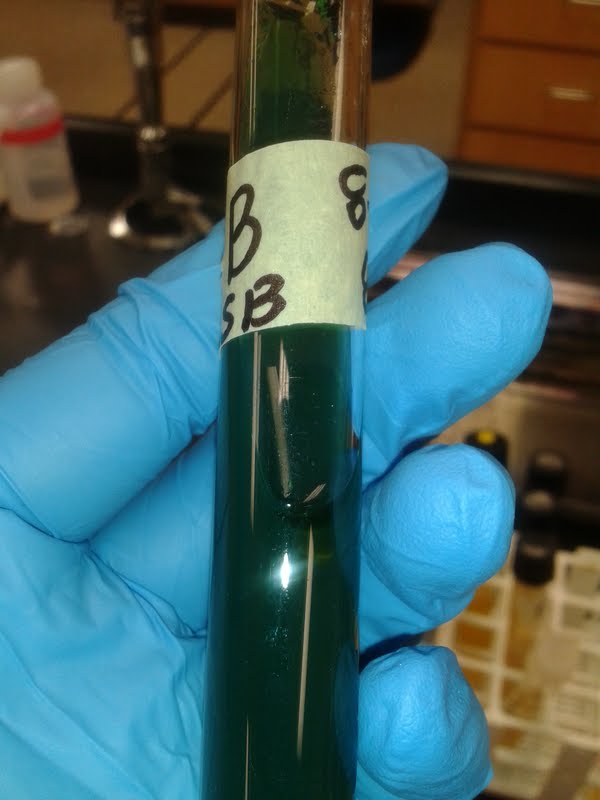 Microbiology EJournal: Day 33-The Mannitol PR Broth results were - on ...