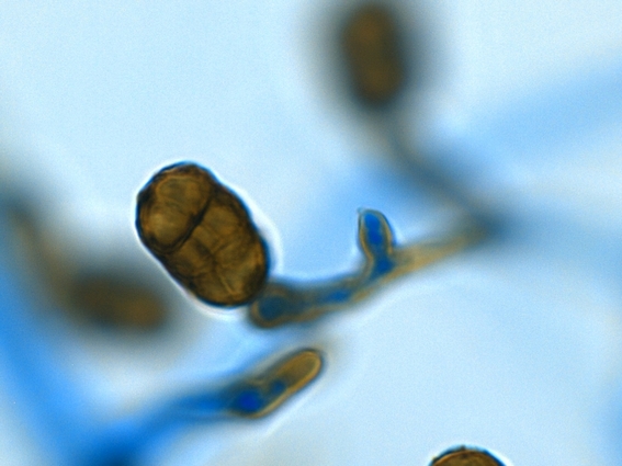 Fun With Microbiology (What's Buggin' You?): Stemphylium species