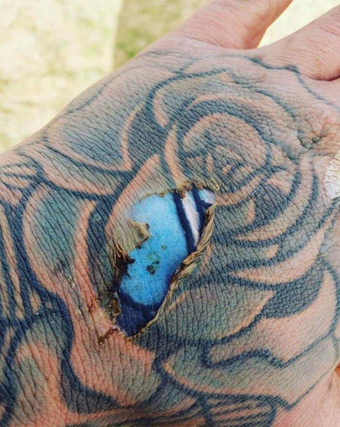 Os Velhotes Dos Marretas Tatuagens renovadas Ap s Queimaduras De 2 Grau os-velhotes-dos-marretas-tatuagens-renovadas-ap-s-queimaduras-de-2-grau