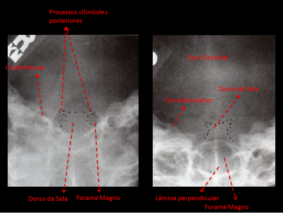 Laboratório de Roentgen: Crânio e Face