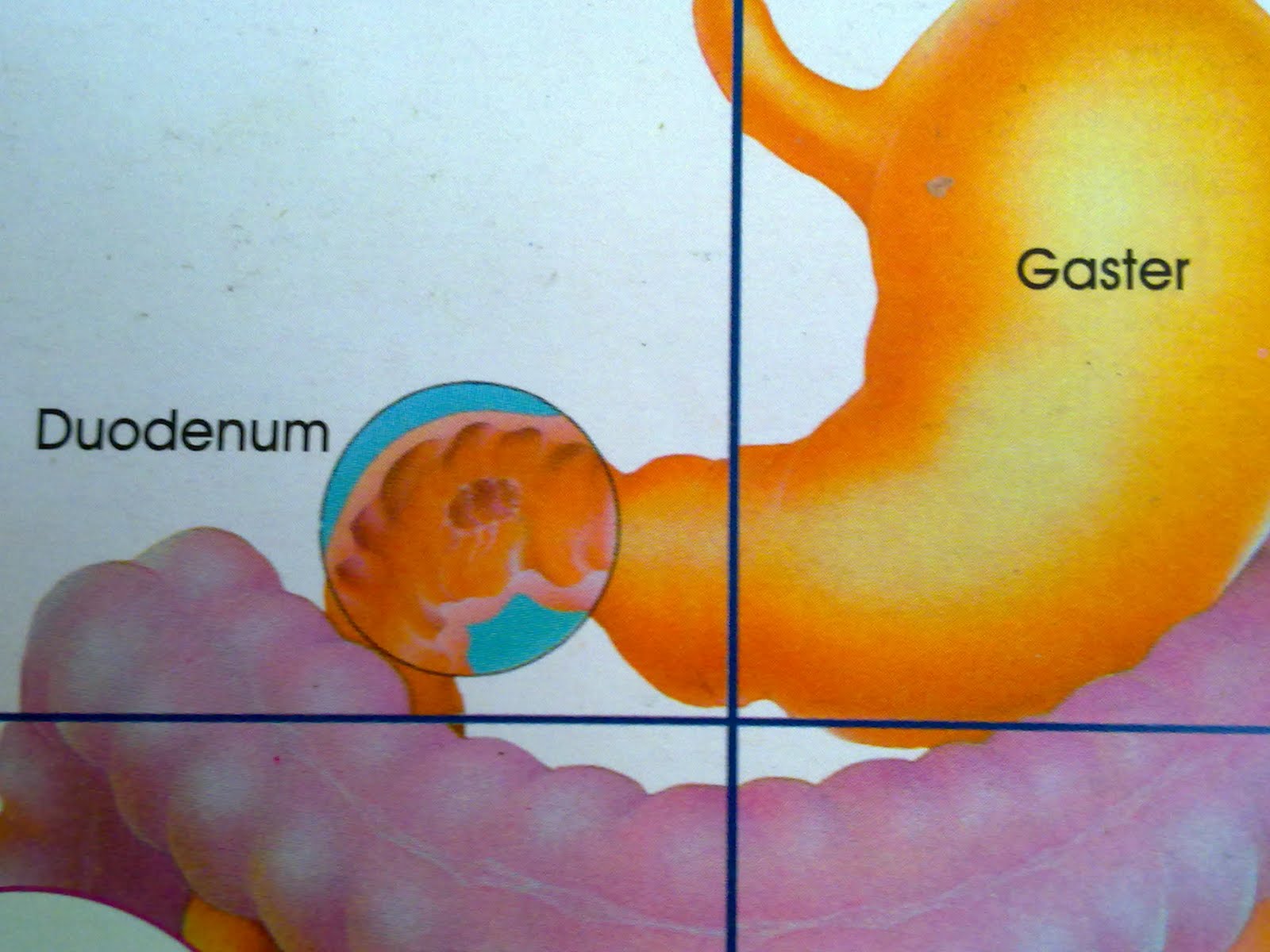 Kesehatan: Sakit Maag