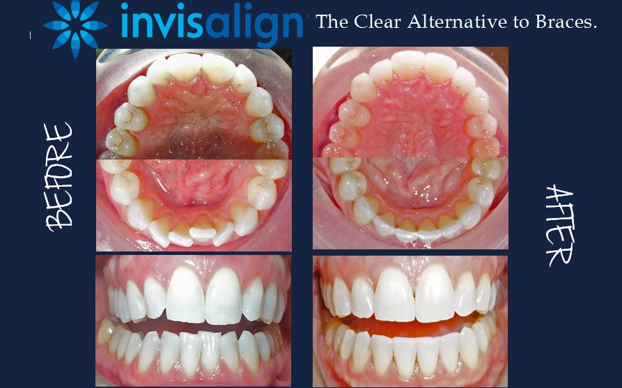 Lund Dental Associates Blog: 2015