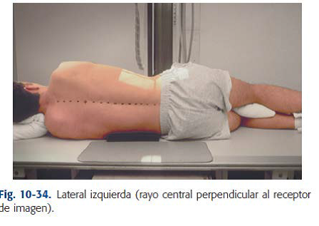 PRODUCCION Y TRATAMIENTO DE IMAGENES DIAGNOSTICAS: CAPITULO COLUMNA ...