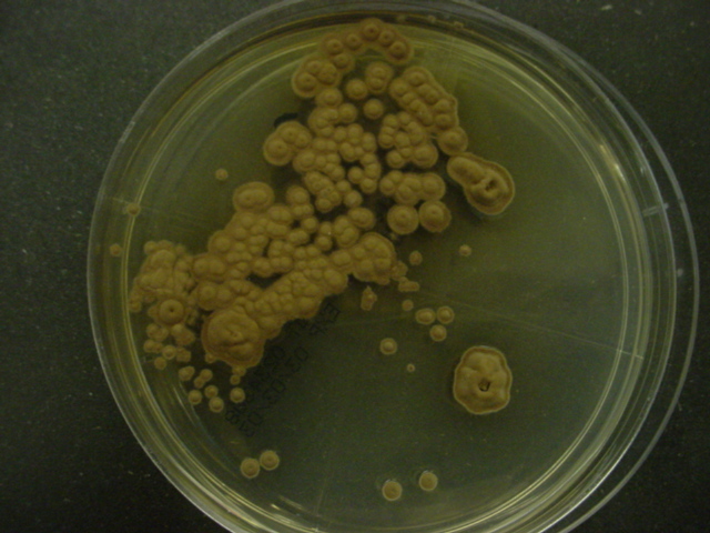 Sustainable Mycology: Wallemia mycotoxin