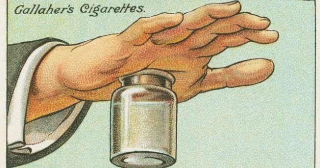 Splinter verwijderen