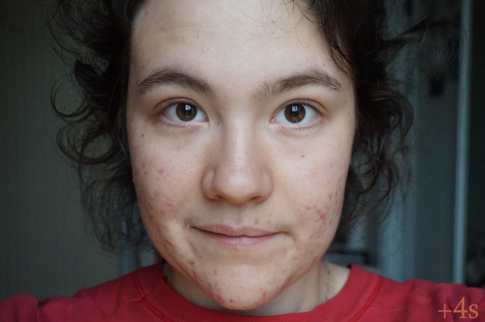 At War with Acne: Cicalfate & TriAcnéal Expert (Avène) won ! - Flavour ...