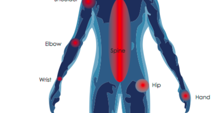 India. Affordable Pulsed signal therapy PST® for Osteoarthritis ...