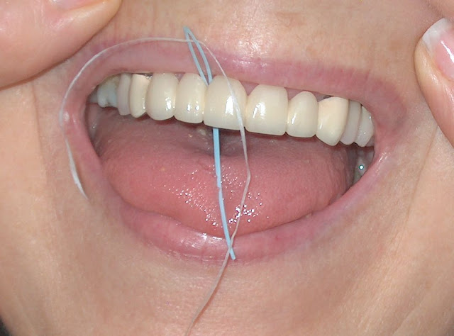 Bridge Garden Picture: Bridge Dental Floss
