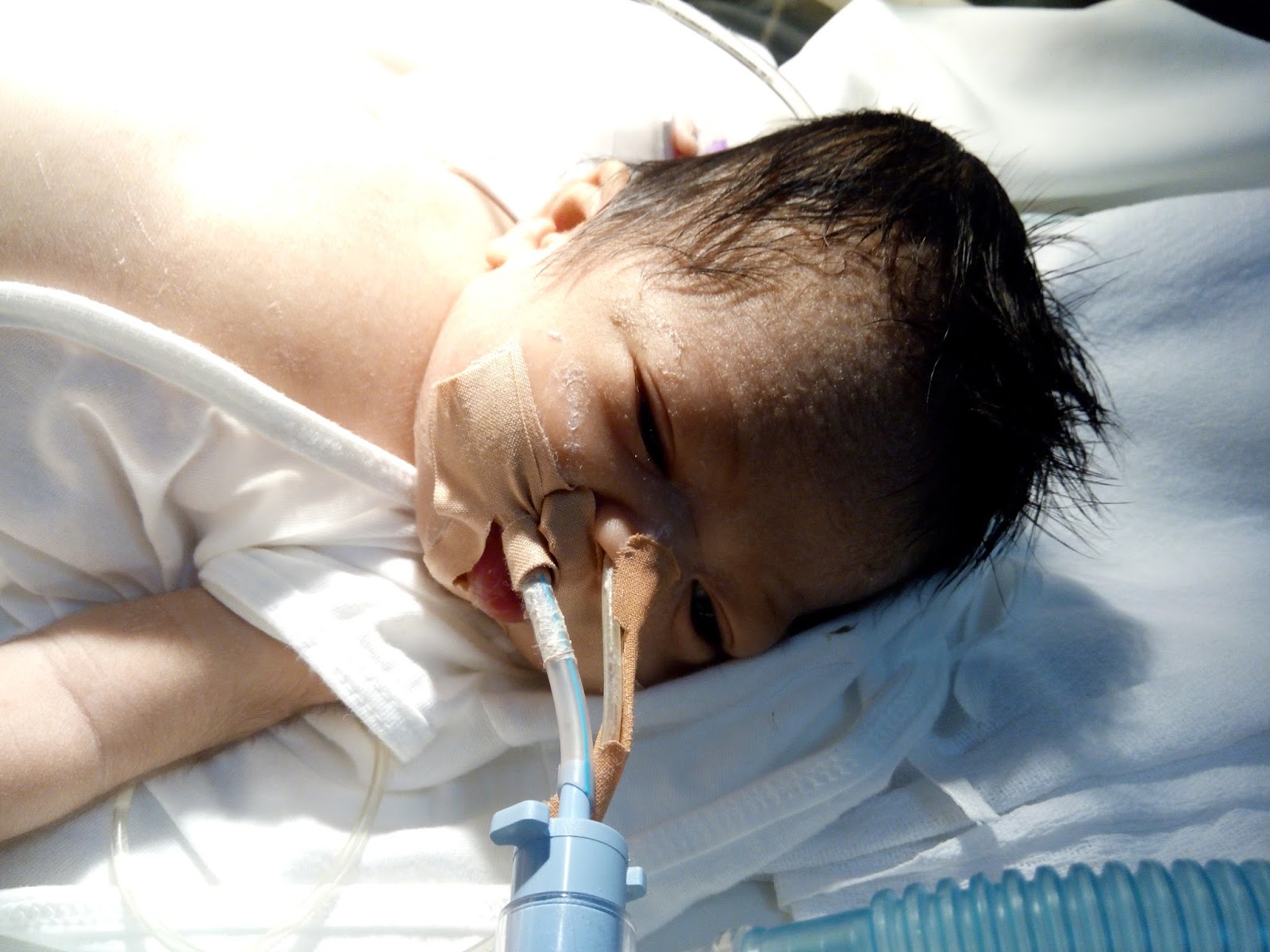Parents of a sick newly born baby appealed for help | POLICE HEADLINES
