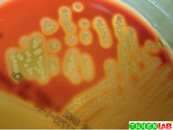 [Microbiology] Atlas of Aerobic Gram-Positive Bacilli | Free Medical Atlas