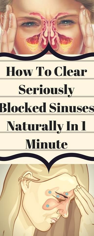 HOW TO CLEAR SERIOUSLY BLOCKED SINUSES NATURALLY IN 1 MINUTE | HEALTHYLIFE