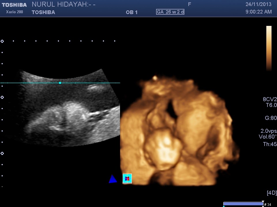 Menuju Destinasi Cinta: Mikhail Iman Hafiy...Kamu Hero Mama