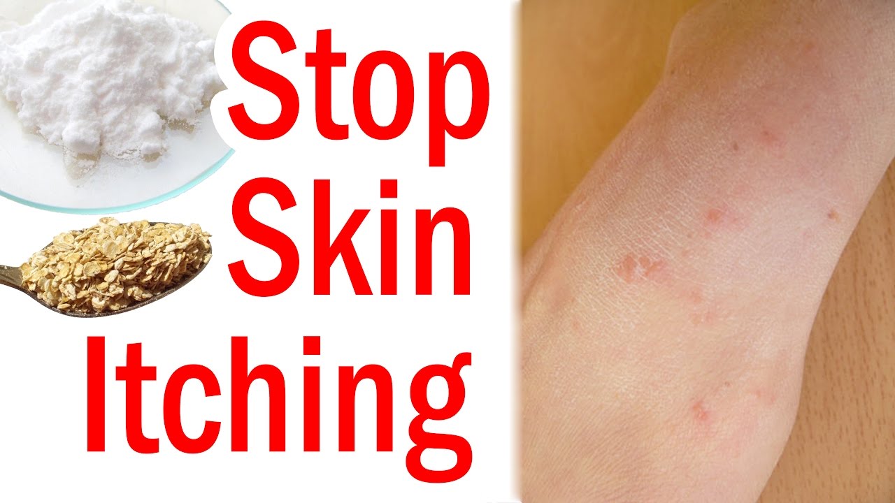 खुजली से निपटने के घरेलू उपाय (Home Remedies For Itching Skin) || How ...