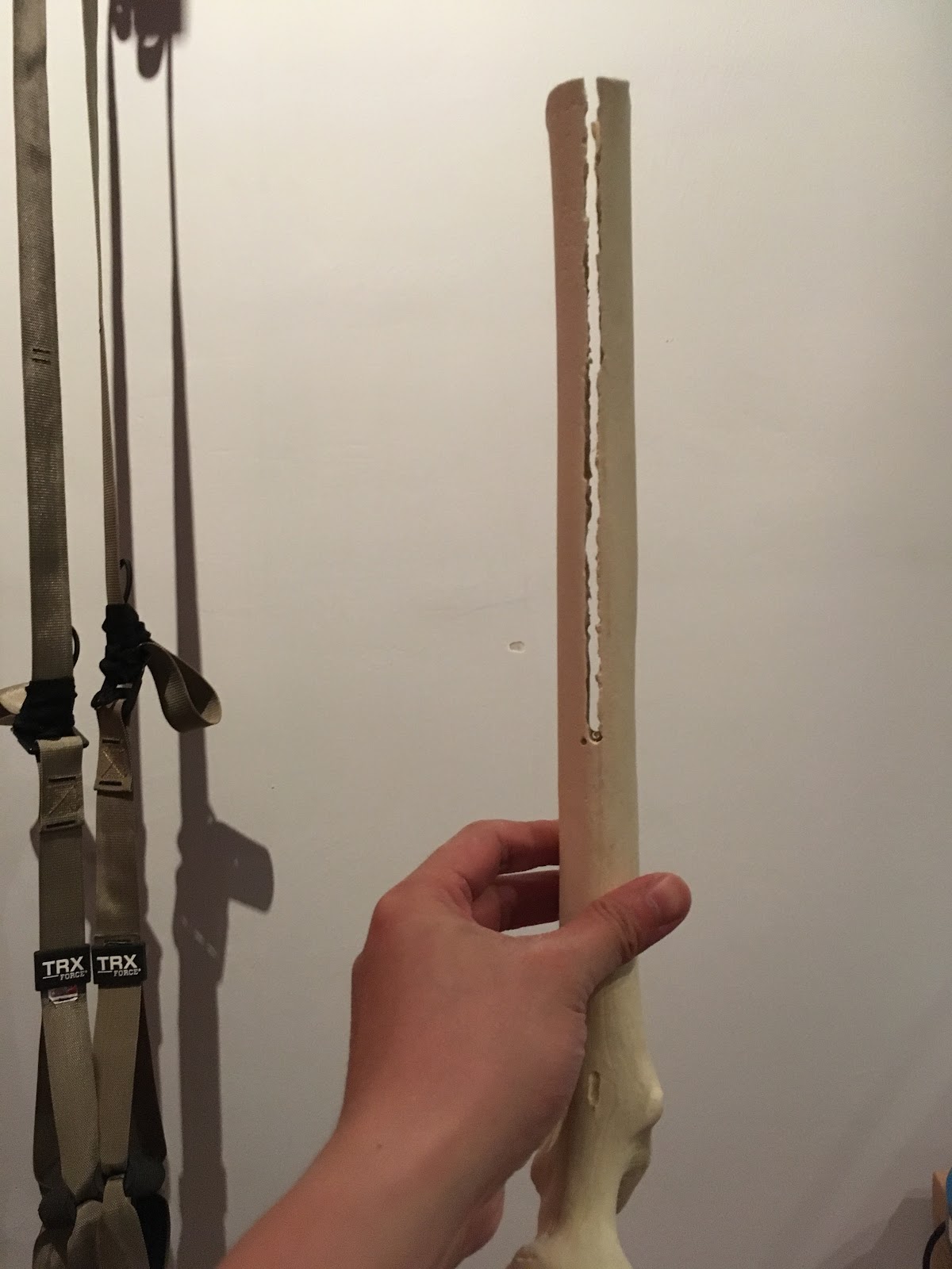 Orthopod Transforms! : Hone-jato (bone ninjato)