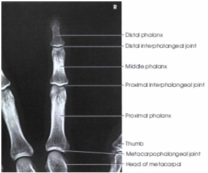 Study of digits (second through fifth) | Radiology