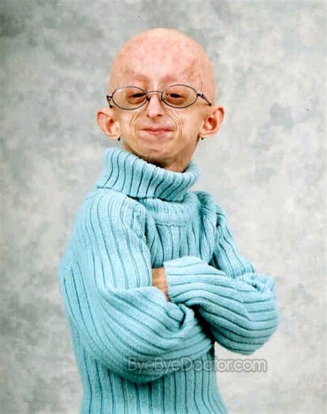 Progeria